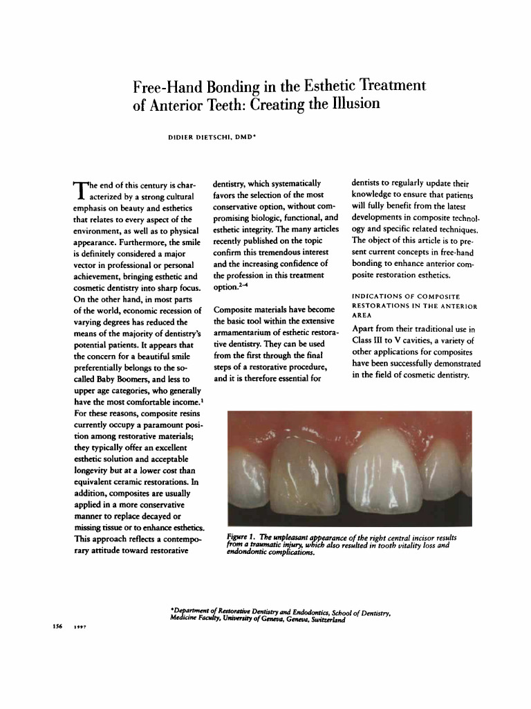 Free Hand Bonding in The Esthetic Treatm | PDF | Tooth Enamel | Human Tooth