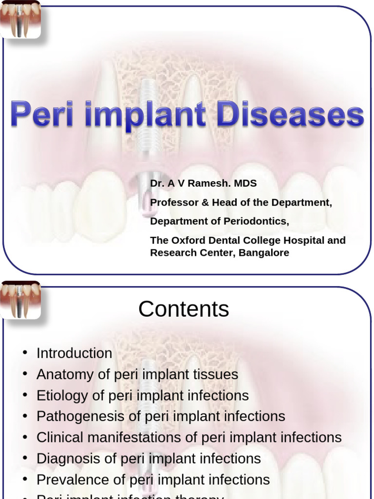Peri Implant Diseases | PDF | Periodontology | Dental Implant