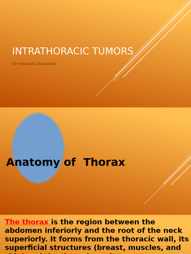 Intrathoracic Tumors | PDF | Thorax | Diseases And Disorders