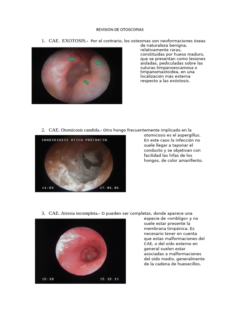 Revision de Otoscopias | PDF | Oído | Otología