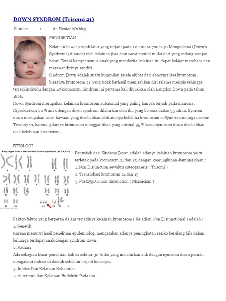 Down Syndrome | PDF
