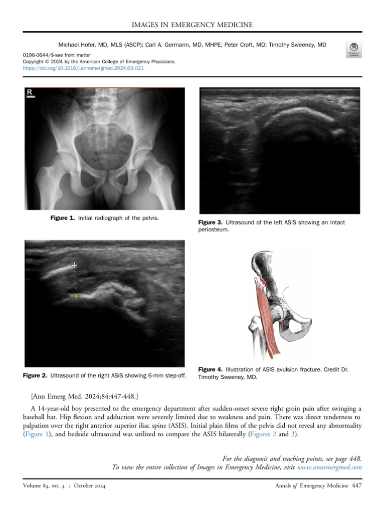 Adolescent Male With Sudden, Severe Onset Right GR | PDF | Pelvis | Hip