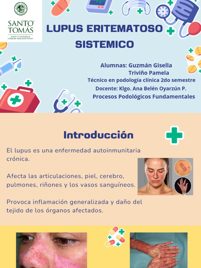 Lupus Eritematoso Sistemico-1-1 | PDF | Medicina CLINICA | Enfermedades ...