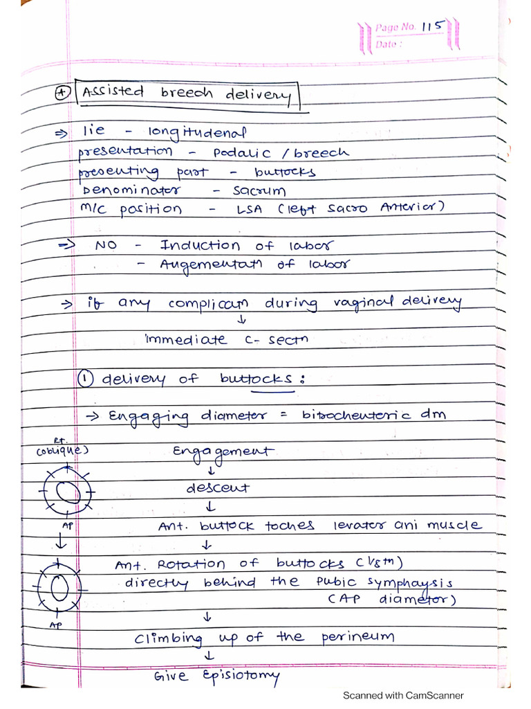 Assisted Breech Delivery-2 | PDF