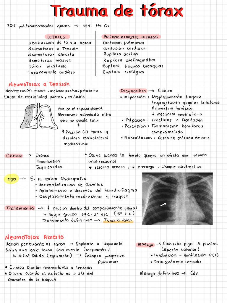 Trauma De Tórax | PDF | Pulmón | Medicina CLINICA