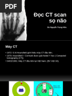ĐỌC CT SCAN SỌ NÃO | PDF