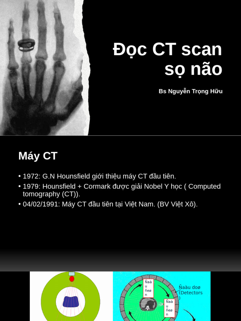 Đọc CT scan sọ não | PDF