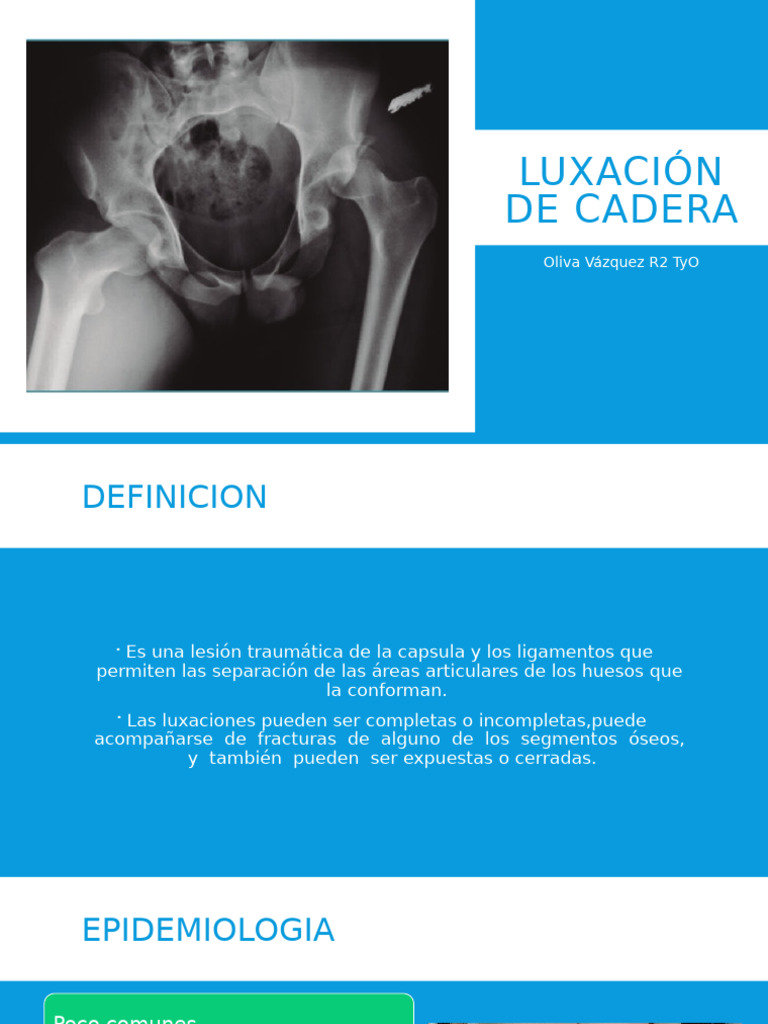 Luxación de cadera | PDF | Sistema musculoesquelético | Lesión