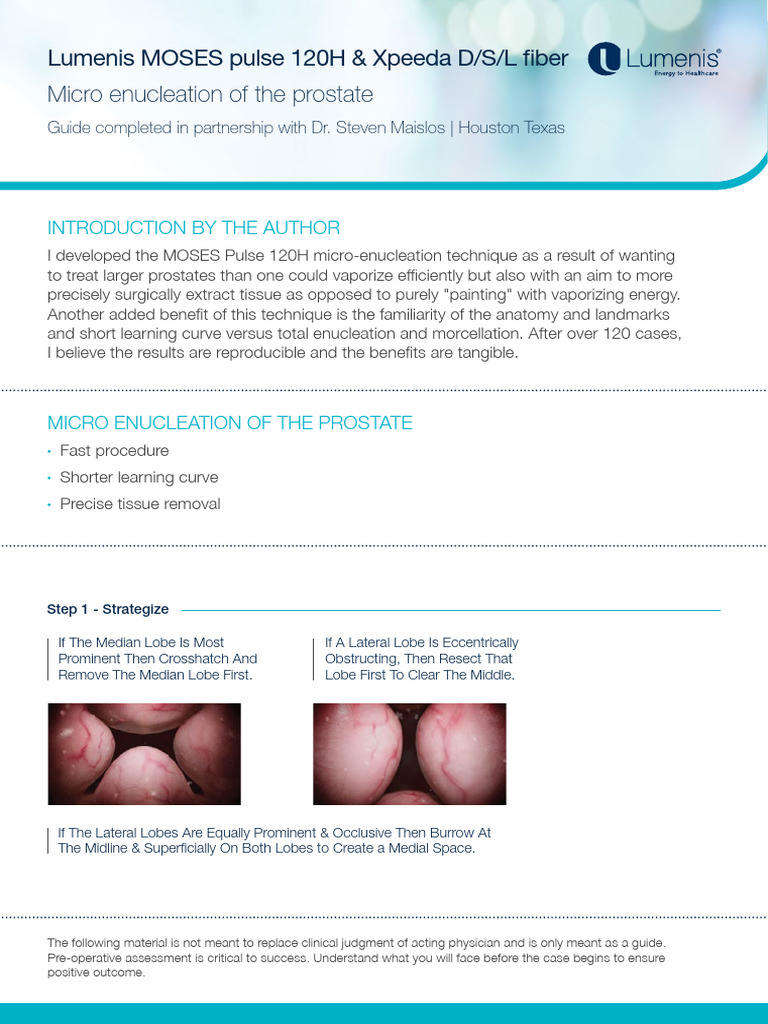 Pulse 120H and Xpeeda Micro Enucleation Guide - A4 - PB-2011373 Rev A | PDF | Laser | Clinical ...