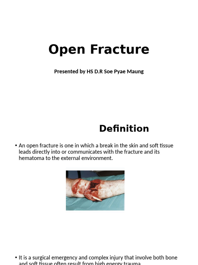 Open Fracture | PDF | Wound | Surgery