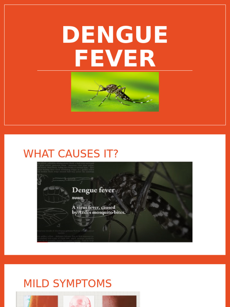 Dengue Fever Hazel | PDF