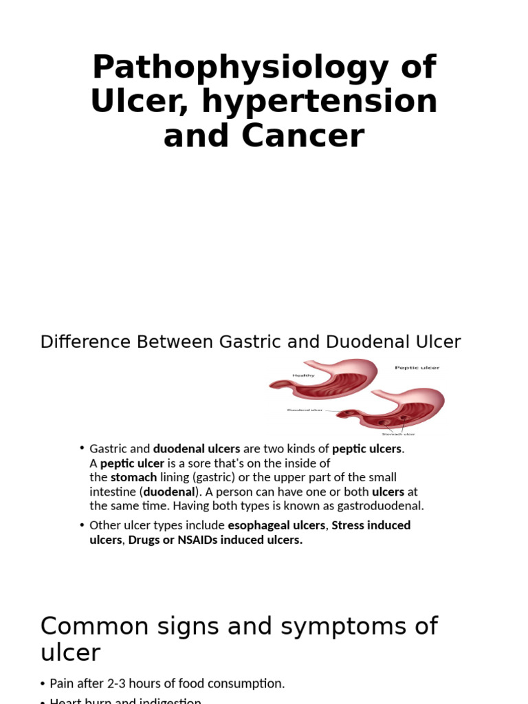 Pathophysiology of Ulcers, Hypertension, and Cancer | PDF ...