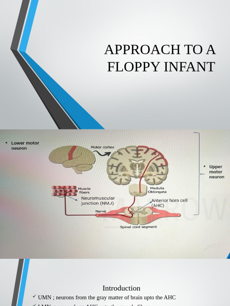 Floppy Infant | PDF | Weakness | Neuromuscular Junction