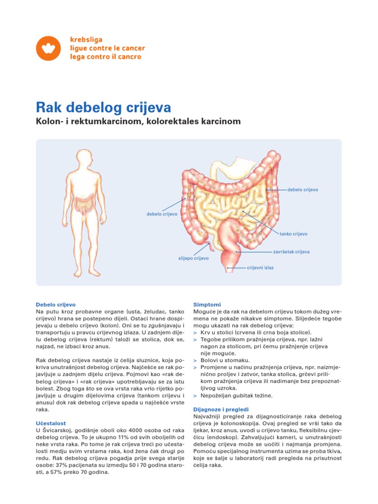Rak Debelog Crijeva | PDF
