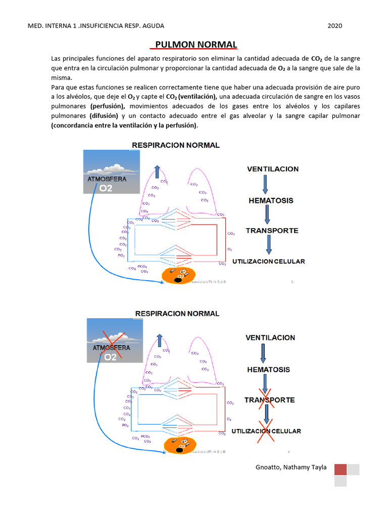 Insuf. Resp Aguda | PDF | Sistema respiratorio | Pulmón