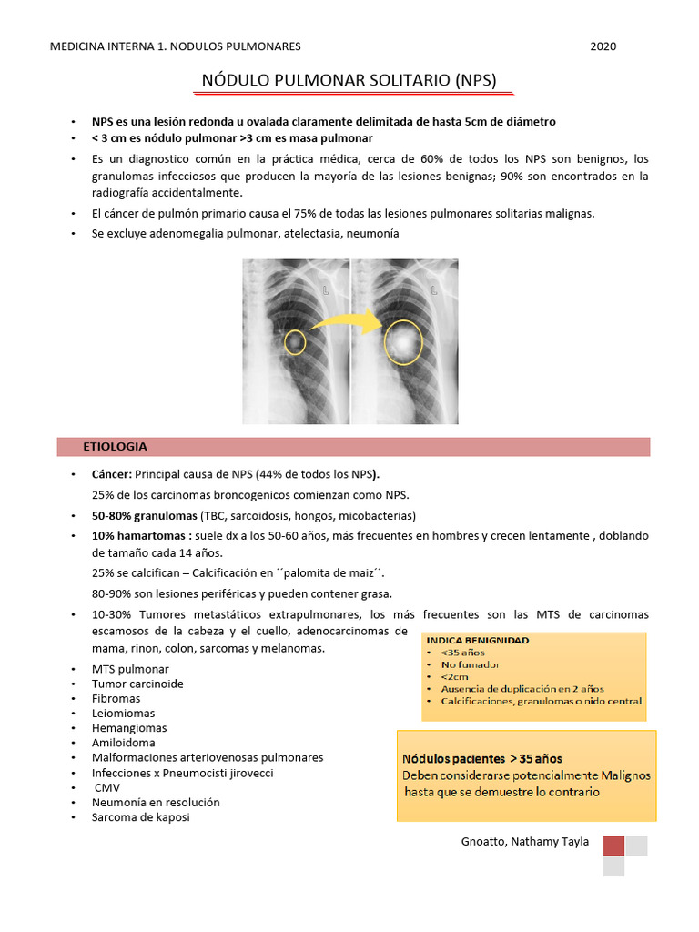 Nódulo Pulmonar Solitario | PDF | Cáncer | Cáncer de pulmón