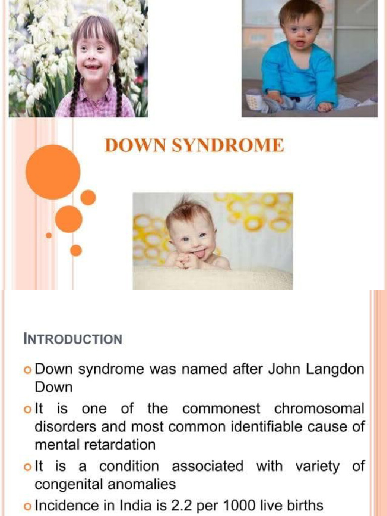 Down Syndrome | PDF