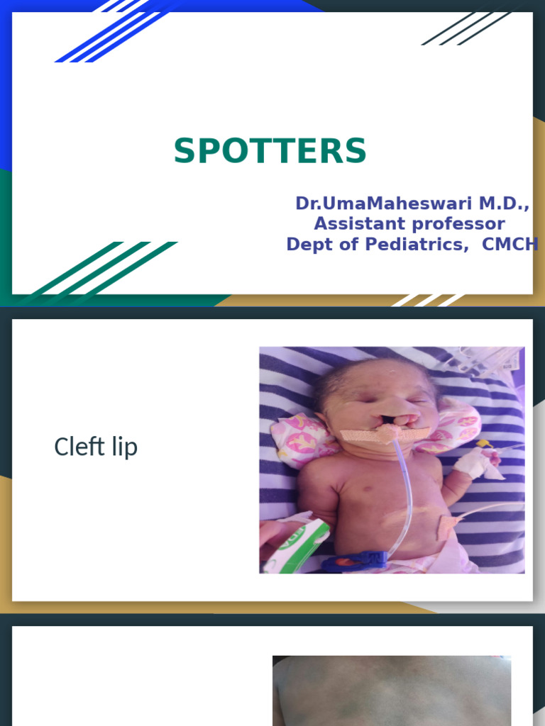 Paediatrics Spotters | PDF