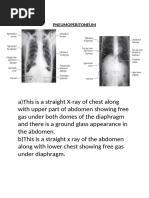 AXR Interpretation - LITFL - CCC Investigations | PDF | Medical ...