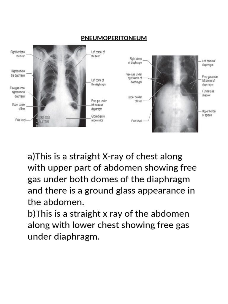 Xrays For Lamination Wordddddddd | PDF | Gastroenterology | Clinical Medicine