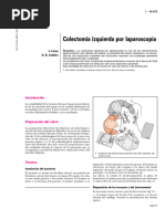 Sigmoidectomía Laparoscópica: Técnica y Equipo | PDF | Intestino grueso ...