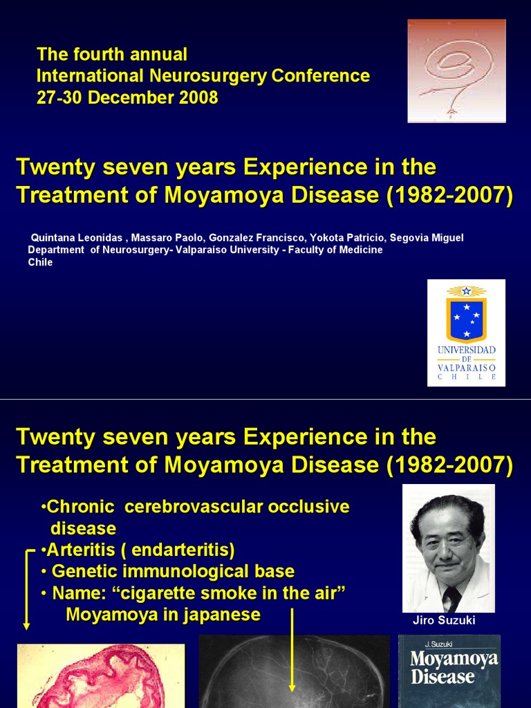 Twenty Seven Years Experience in The Treatment of Moyamoya Disease ...