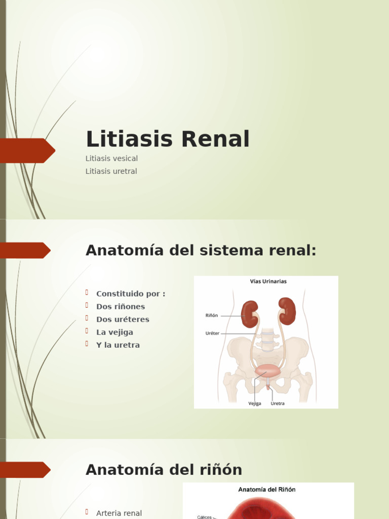 Guía Completa sobre Litiasis Renal | PDF | Riñón | Sistema urinario