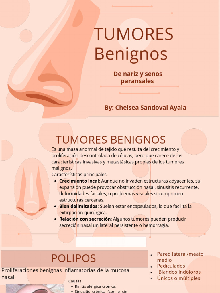 Tumores benignos .pdf | PDF | Nariz humana | Neoplasias