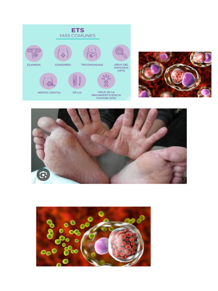 Its Imagenes | PDF