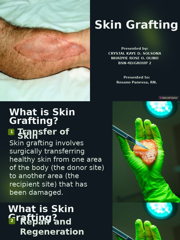 Skin-Grafting-1 | PDF | Skin | Wound