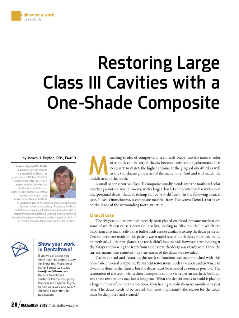 Restoring Large Class III Cavities with a One-Shade Composite | PDF ...