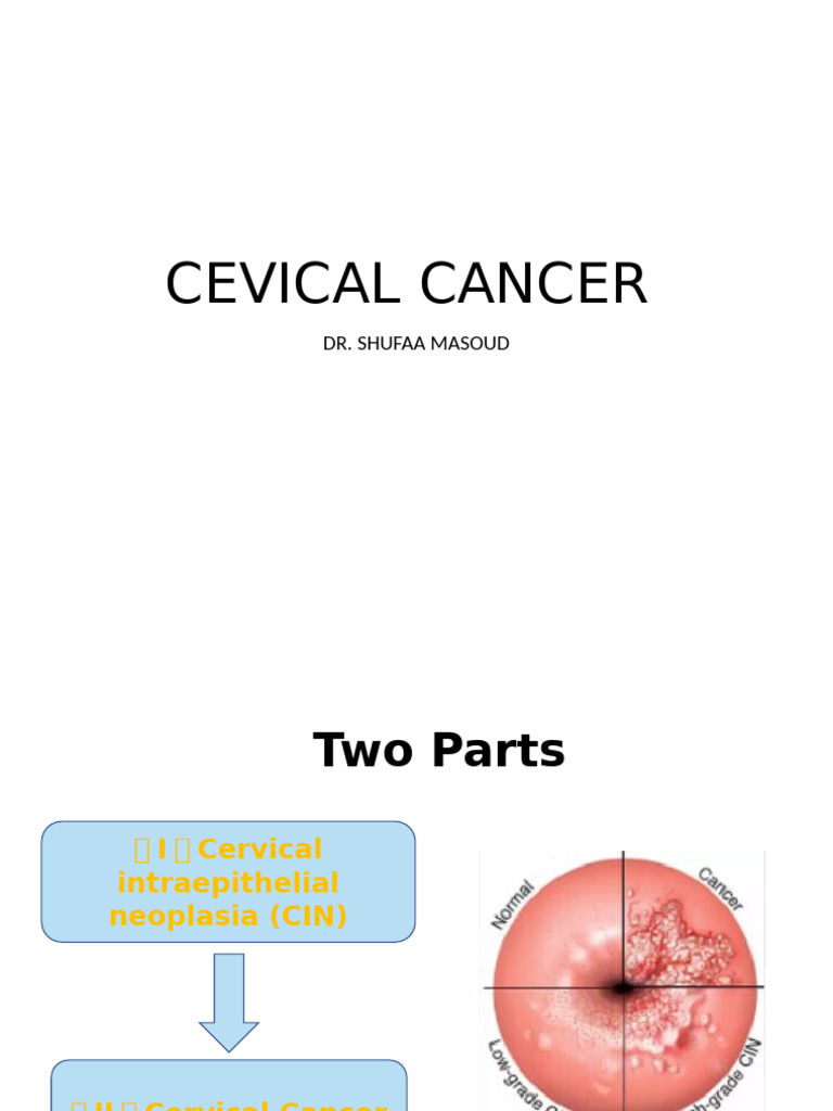 Cervical Cancer | PDF | Cervical Cancer | Metastasis