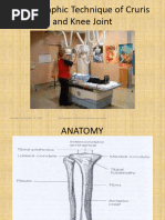 MAKO Knee CT Protocol 1745230796 | PDF | Knee | Ankle