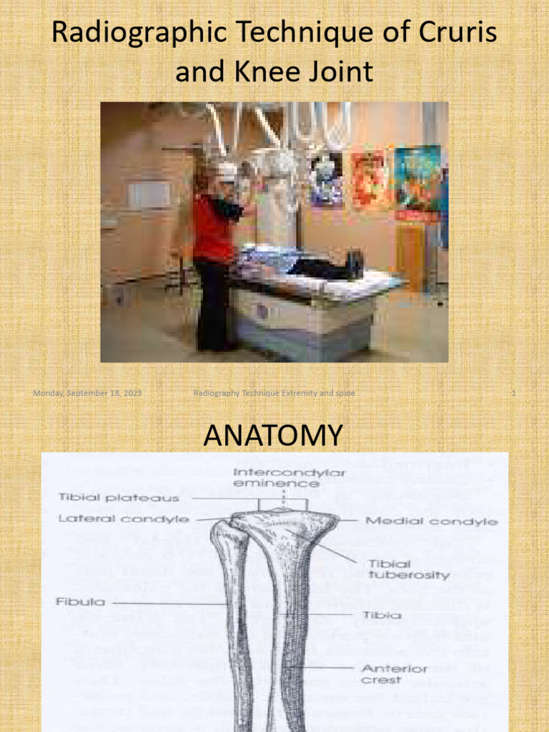 Teknik Radiografi Cruris Dan Knee Joint | PDF | Knee | Human Leg