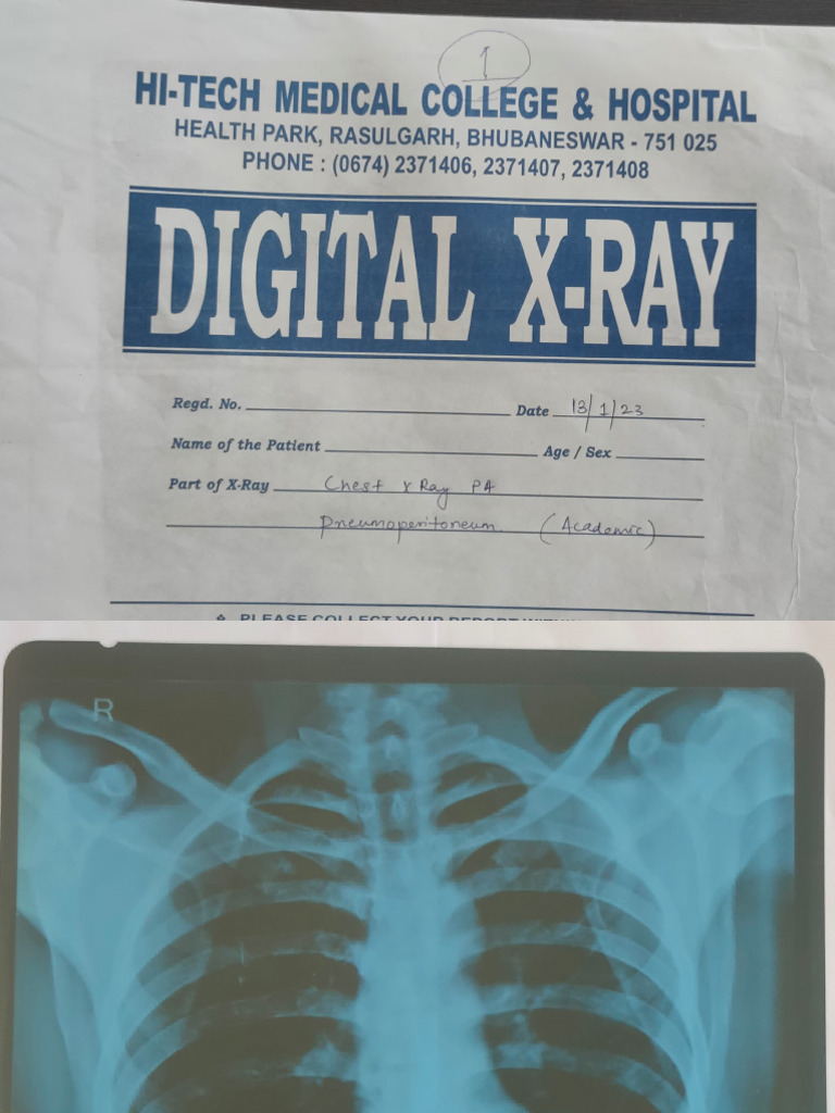 (Medicine) Xray & CT Scan | PDF