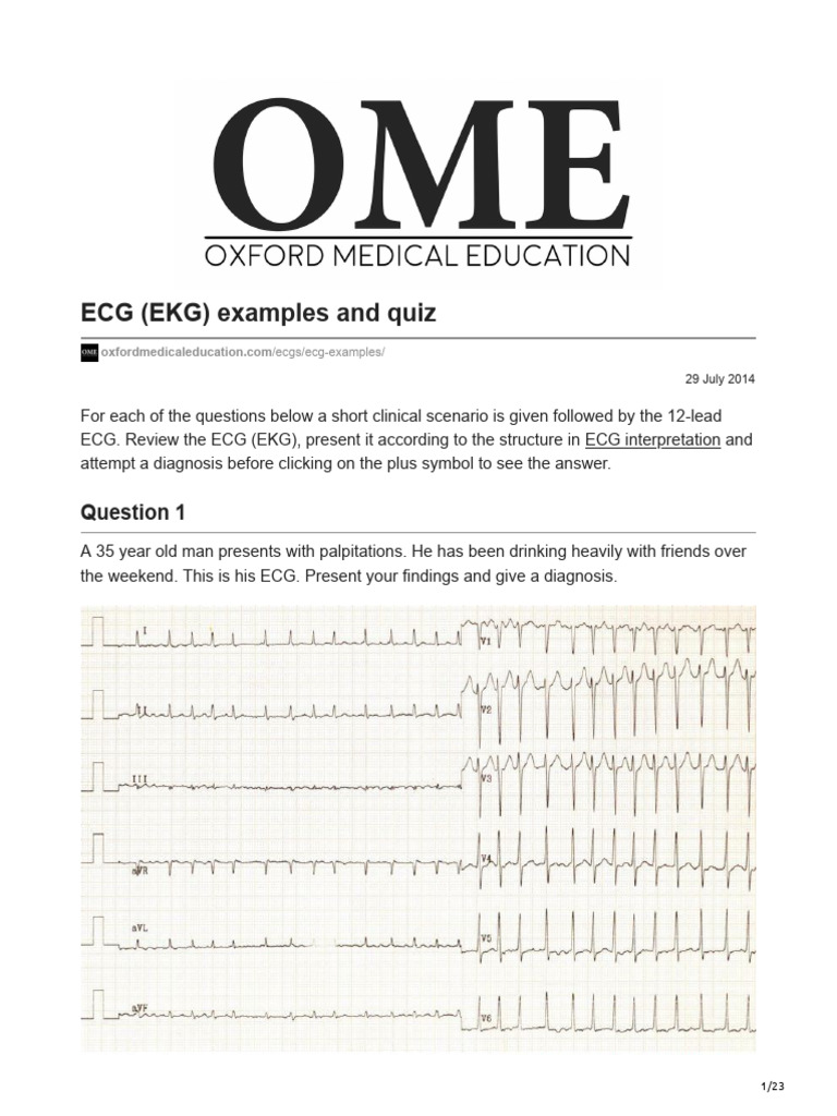ECG EKG Examples and Quiz | PDF | Electrocardiography | Internal Medicine