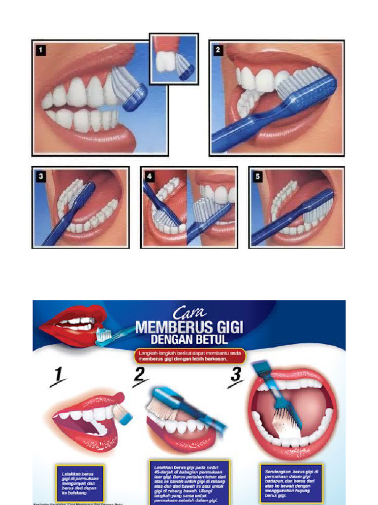 Cara Berus Gigi Betul | PDF