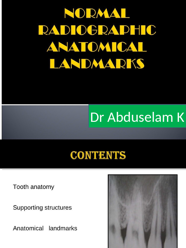 Normal Radiographic Anatomy | PDF