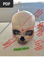 Autopsy Techniques Overview | PDF | Coroner | Autopsy