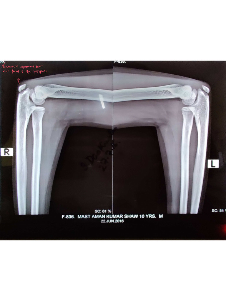 X Ray Plates - 220906 - 180551 Edited | PDF