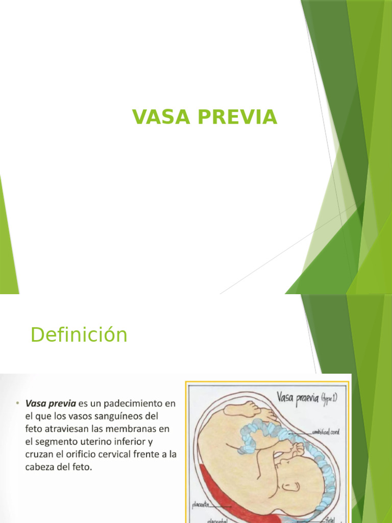 Vasa Previa | PDF