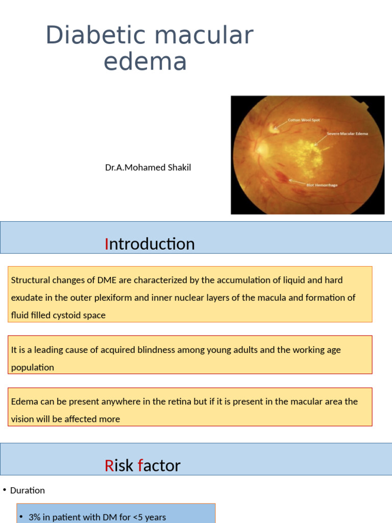 Understanding Diabetic Macular Edema | PDF | Vascular Endothelial ...