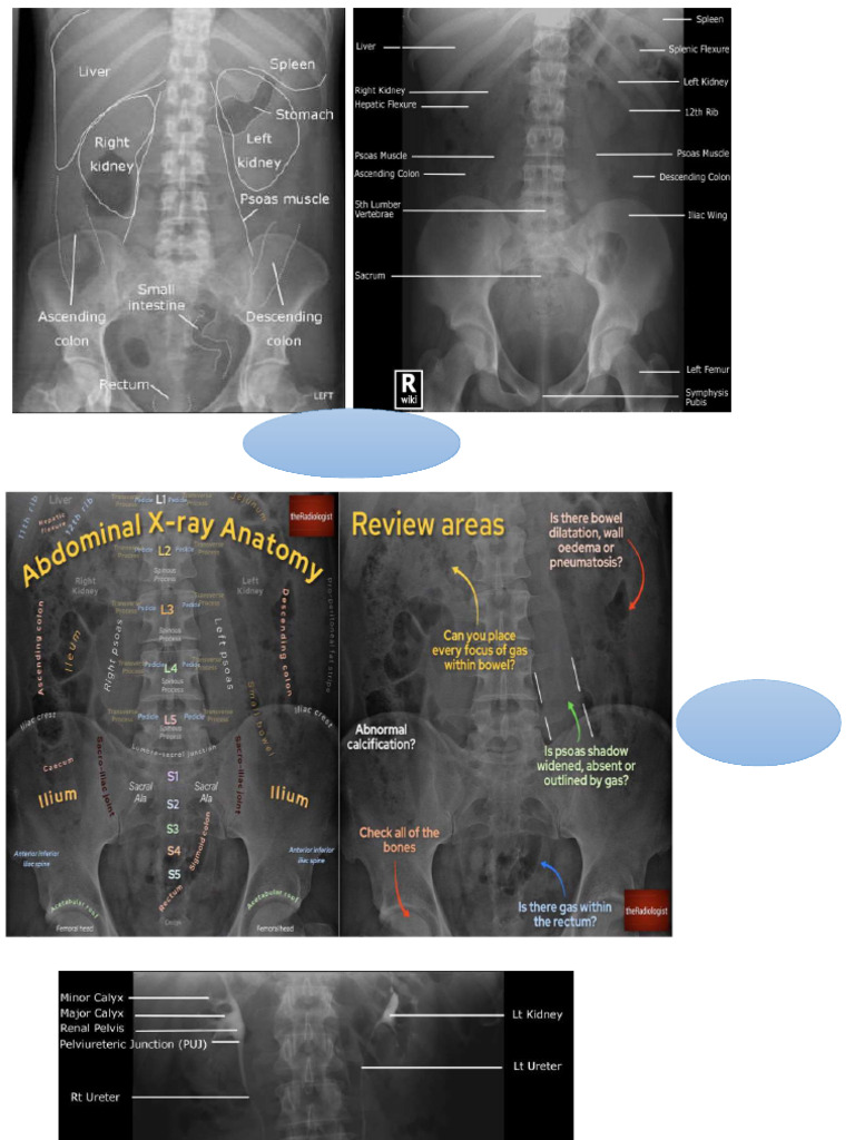 Radiology Abdomen and Pelvis | PDF