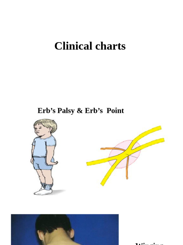 Charts Upper Limb | PDF