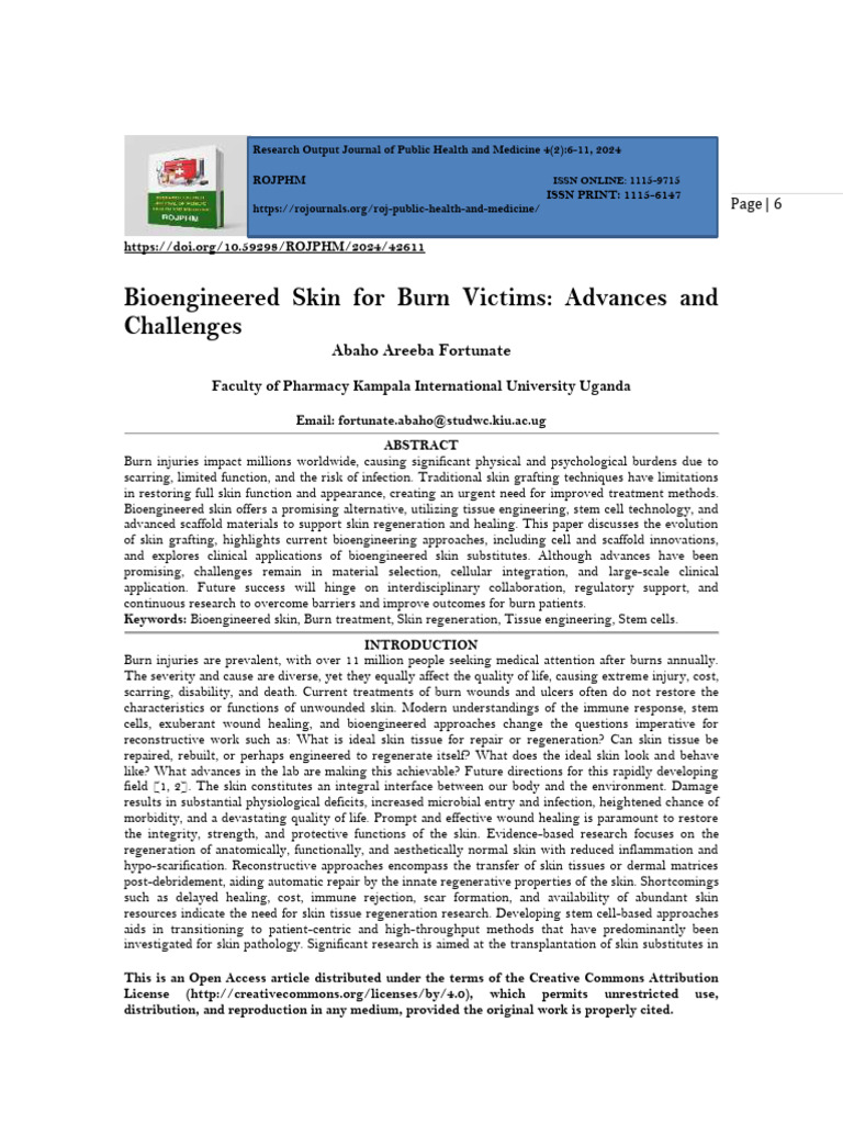 Bioengineered Skin For Burn Victims: Advances and Challenges (WWW - Kiu ...