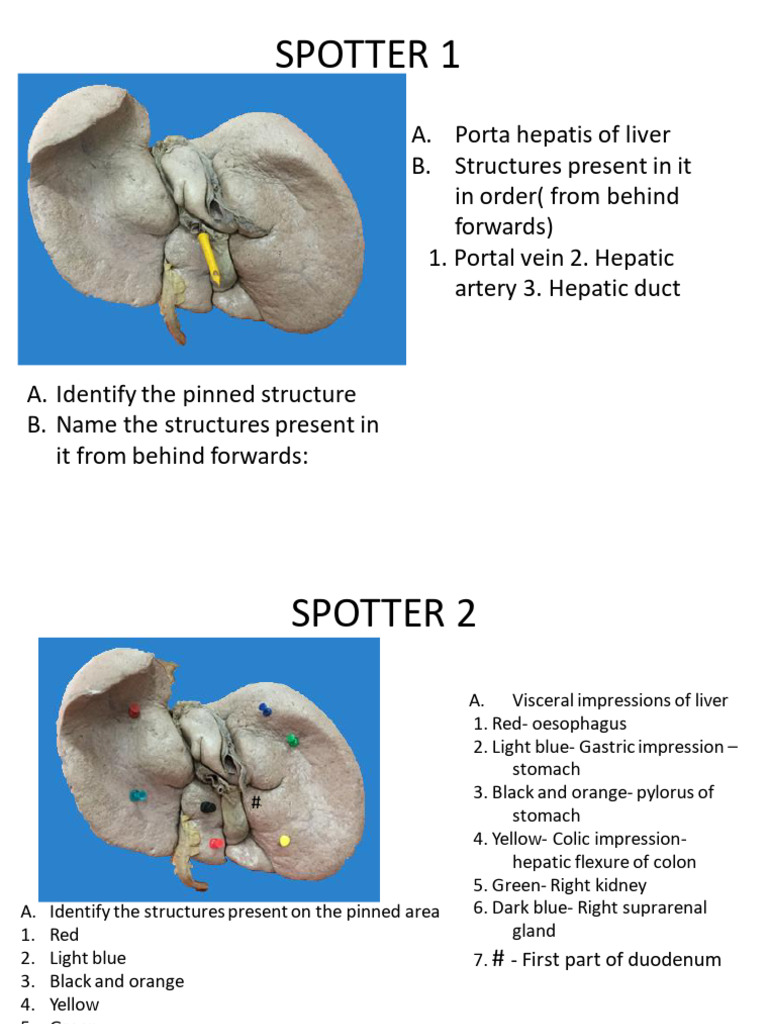 gross anatomy abdomen and pelvis spotters 3 | PDF | Stomach | Pancreas