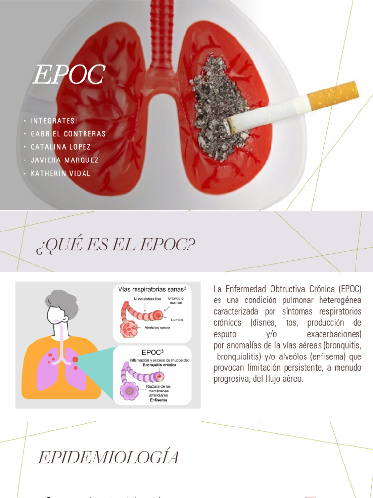 Guía Completa sobre EPOC y su Manejo | PDF | Enfermedad pulmonar ...