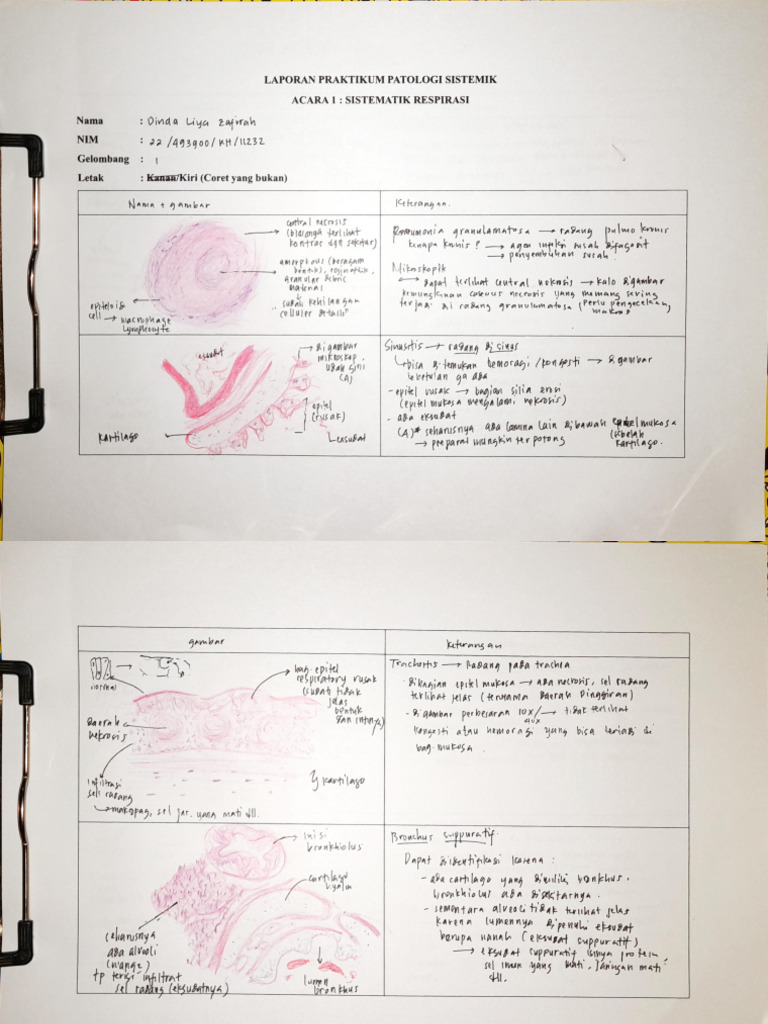 22493900KH11232 - Dinda Liya Zafirah | PDF