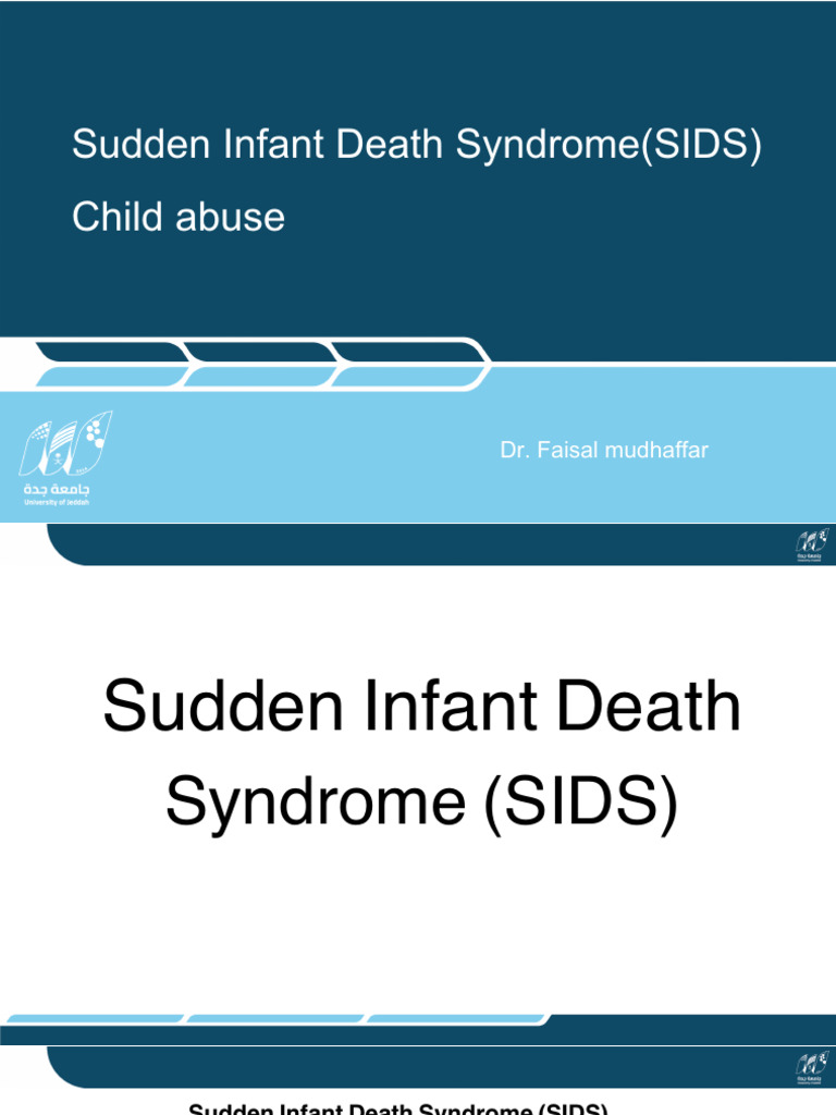 Sids and Child Abuse | PDF