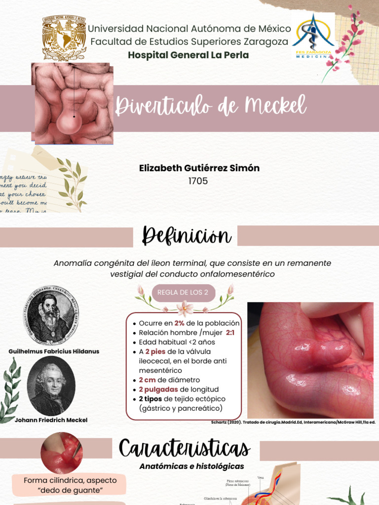 Divertículo de Meckel: Diagnóstico y Tratamiento | PDF | Causas de la ...